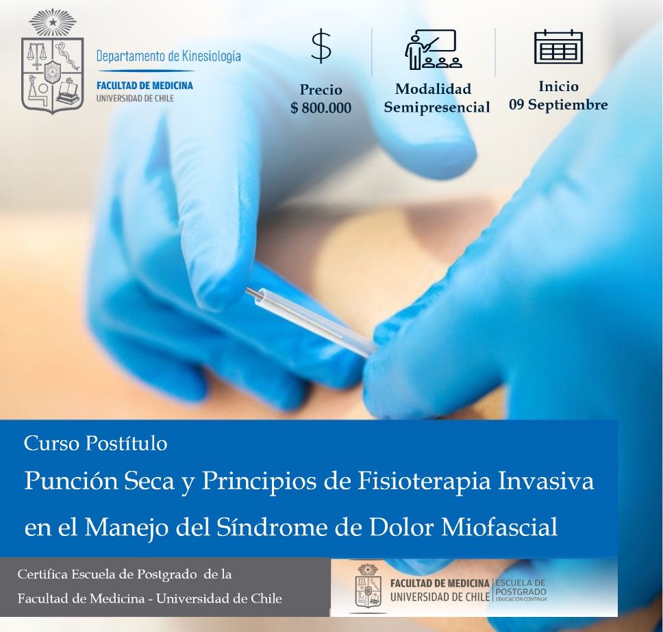 Punción seca y principios de fisioterapia invasiva en el manejo del Síndrome de Dolor Miofascial ...